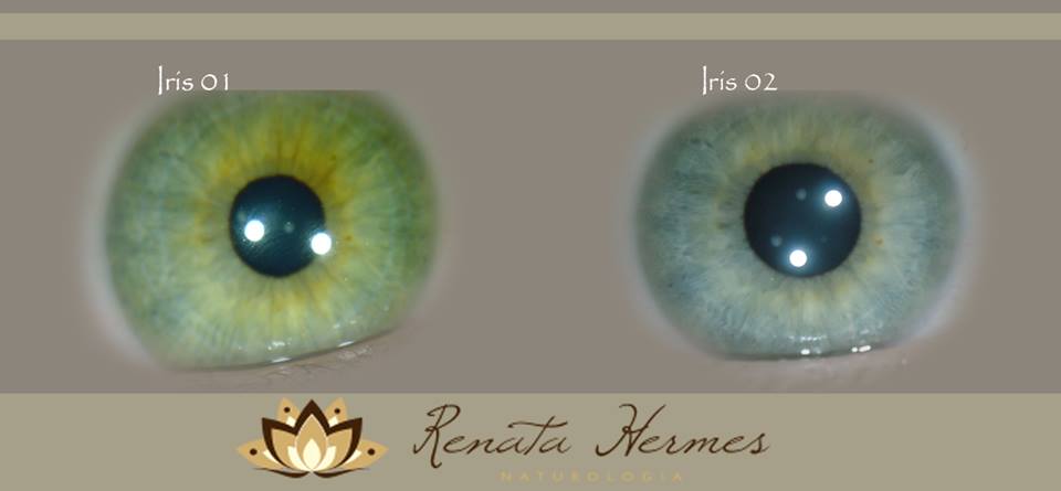 Antes e Depois - Irisdiagnose Renata Hermes